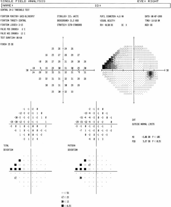 Diagnostic Testing Roseville | Eye Exam Royal Oak